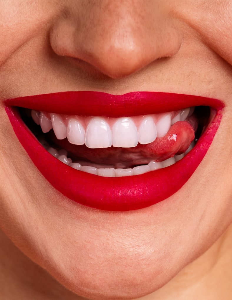 Teeth Whitening - Abbey Mead Dental & Implant Clinic - Plymouth